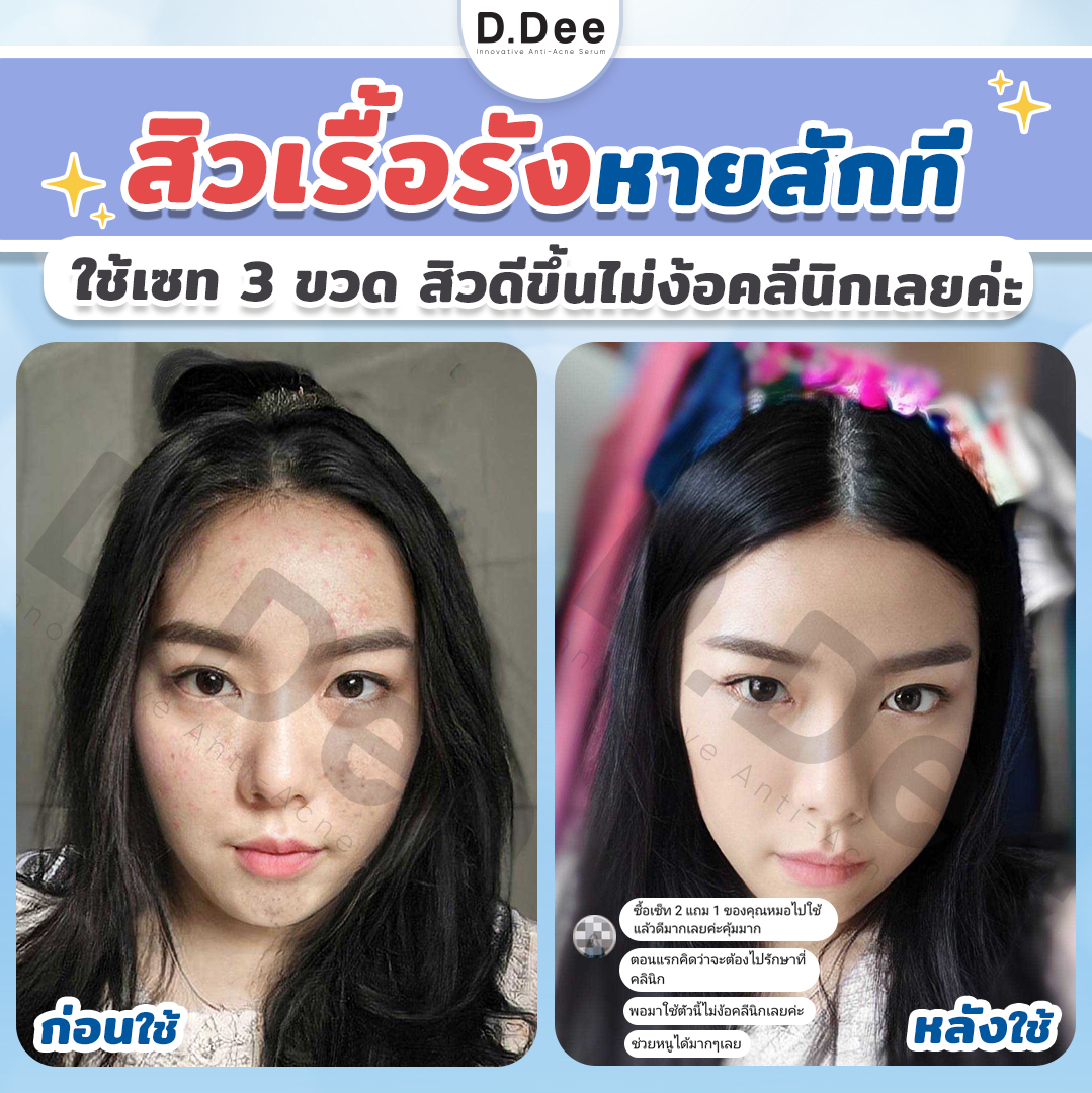 D.Dee, ร้านค้าออนไลน์ | Shopee Thailand