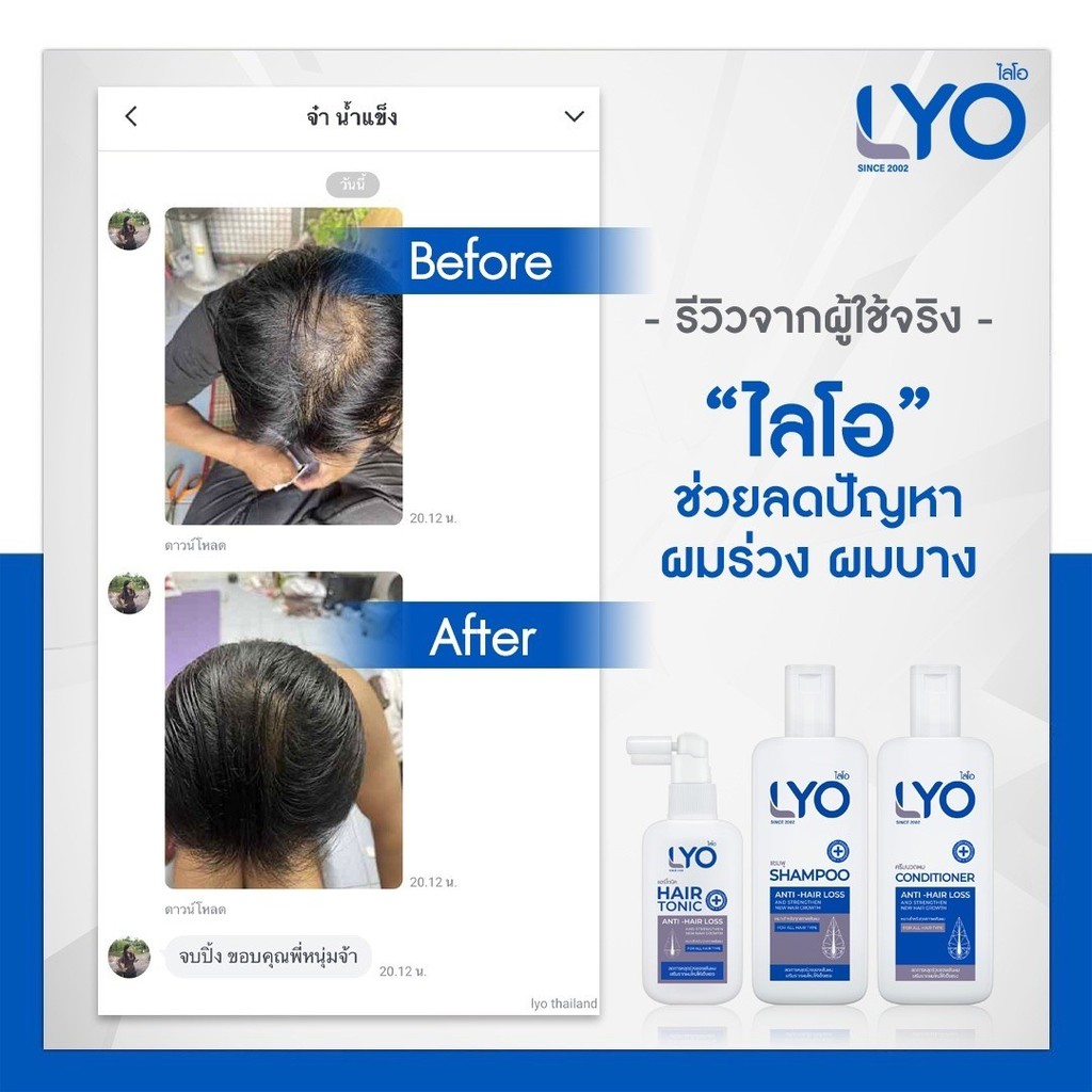 LYO OFFICIAL.TH, ร้านค้าออนไลน์ | Shopee Thailand