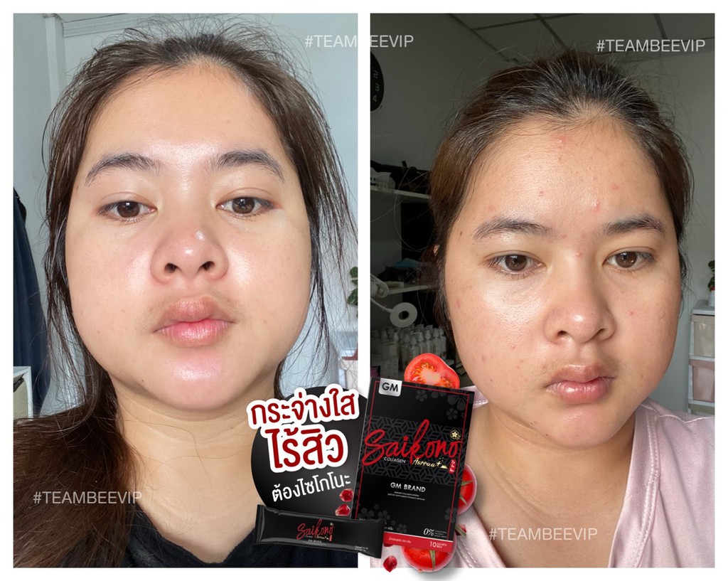beebeskin.official, ร้านค้าออนไลน์ | Shopee Thailand