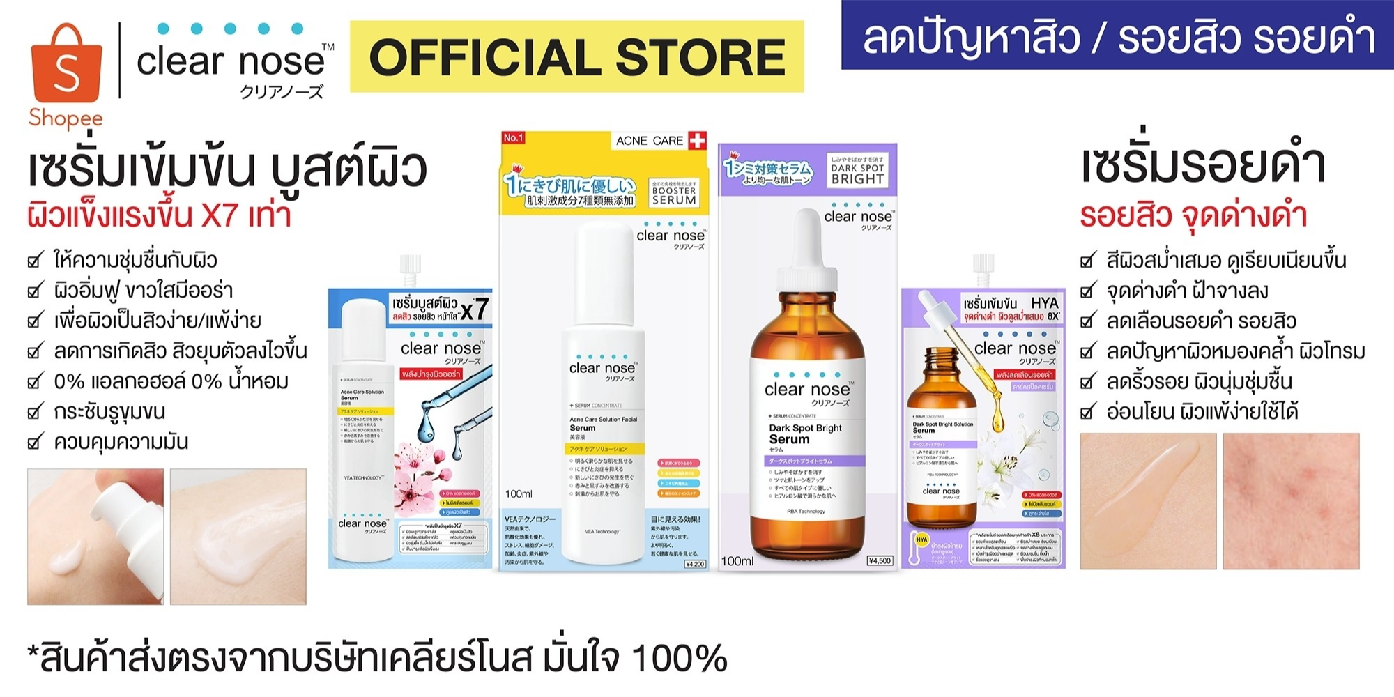 Clearnose Official: Clear Nose, ร้านค้าออนไลน์ | Shopee Thailand