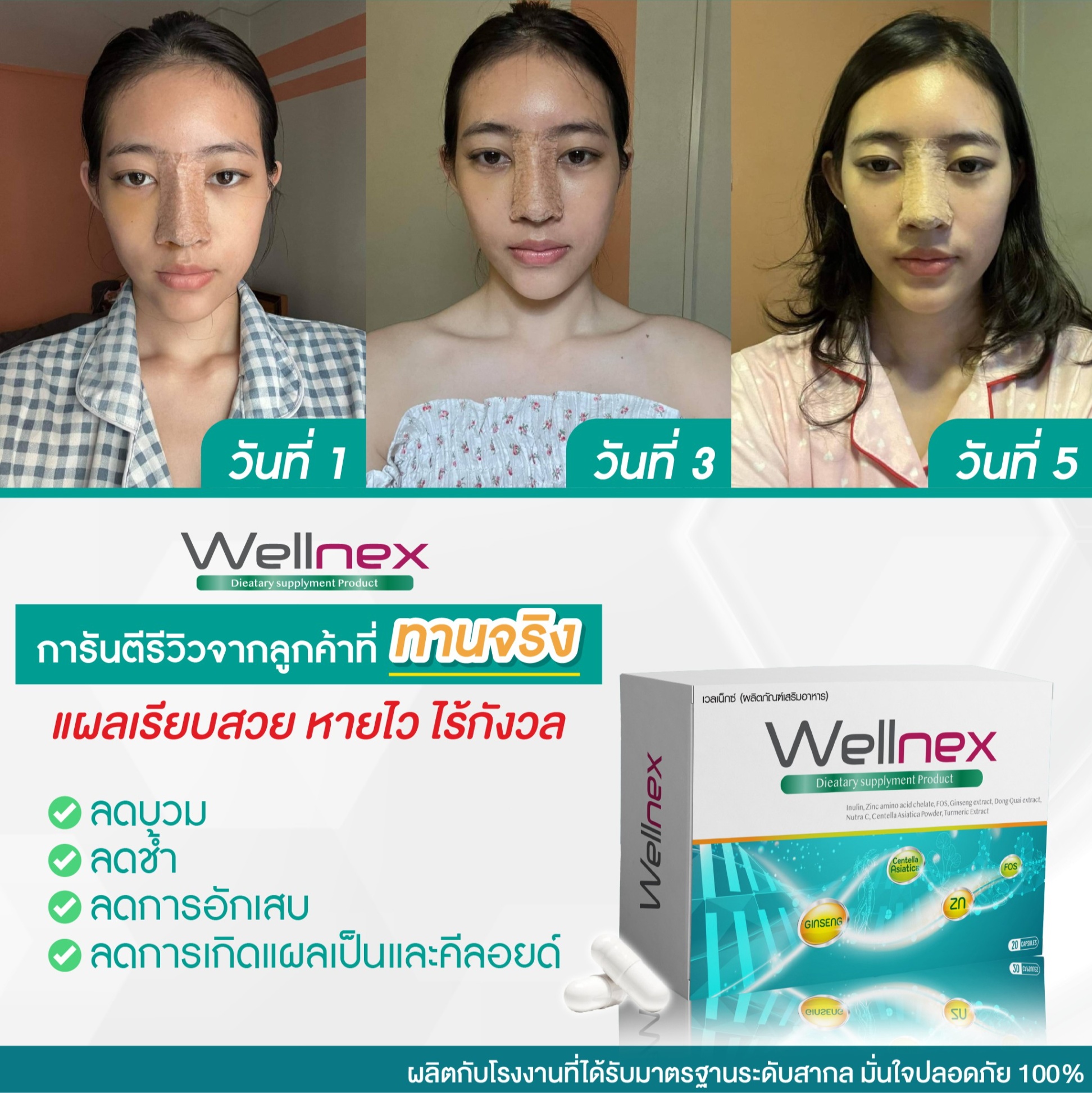 Wellnex ยาลดบวมหลังศัลยกรรม, ร้านค้าออนไลน์ | Shopee Thailand