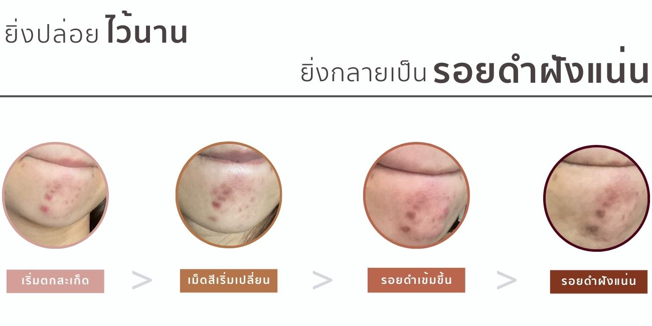 maxkin.official, ร้านค้าออนไลน์ | Shopee Thailand