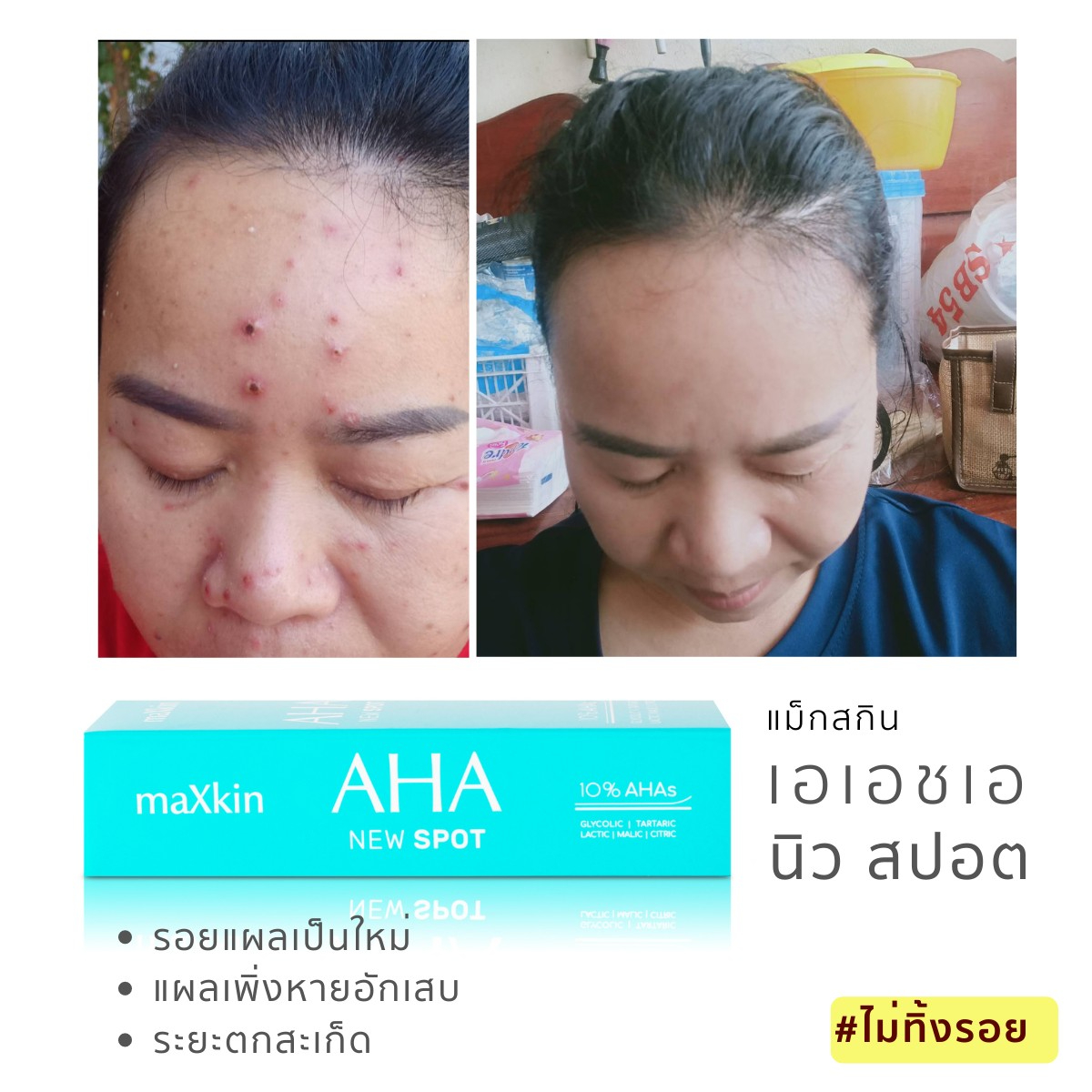 maxkin.official, ร้านค้าออนไลน์ | Shopee Thailand