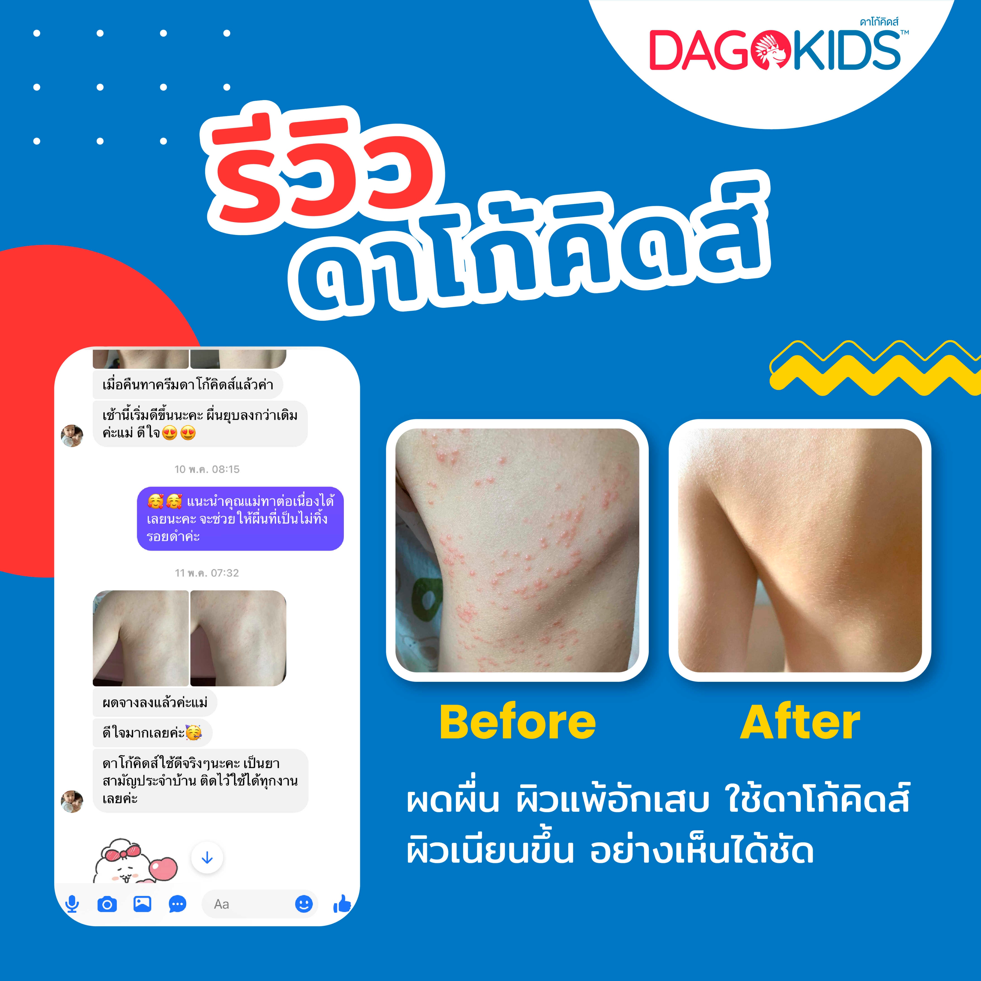 Dagoderma, ร้านค้าออนไลน์ | Shopee Thailand